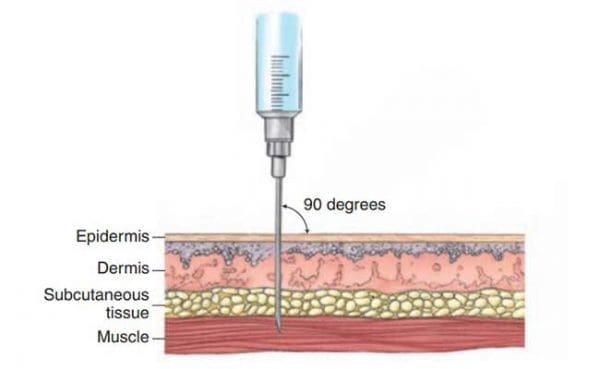 Dhënia e infuzioneve dhe injeksioneve | DOKTORI JUAJ